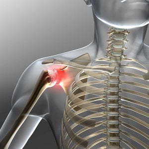 Can Bad Mattress Cause Shoulder Pain? Discover Relief! - Dryer Enthusiast